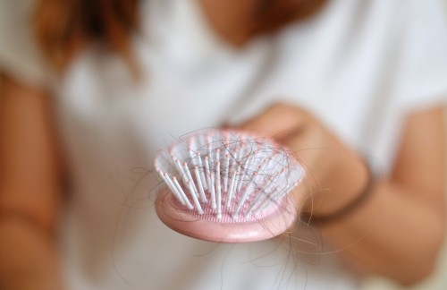 How Much Daily Hair Loss Is Normal? - TomatoBuzz